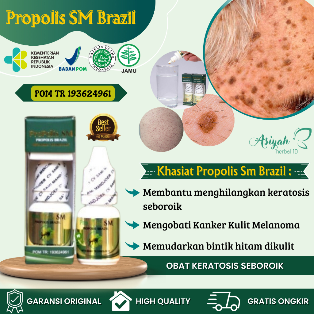 Jual Propolis SM Brazil Obat Tradisional Penghilang Bintik Hitam Di ...