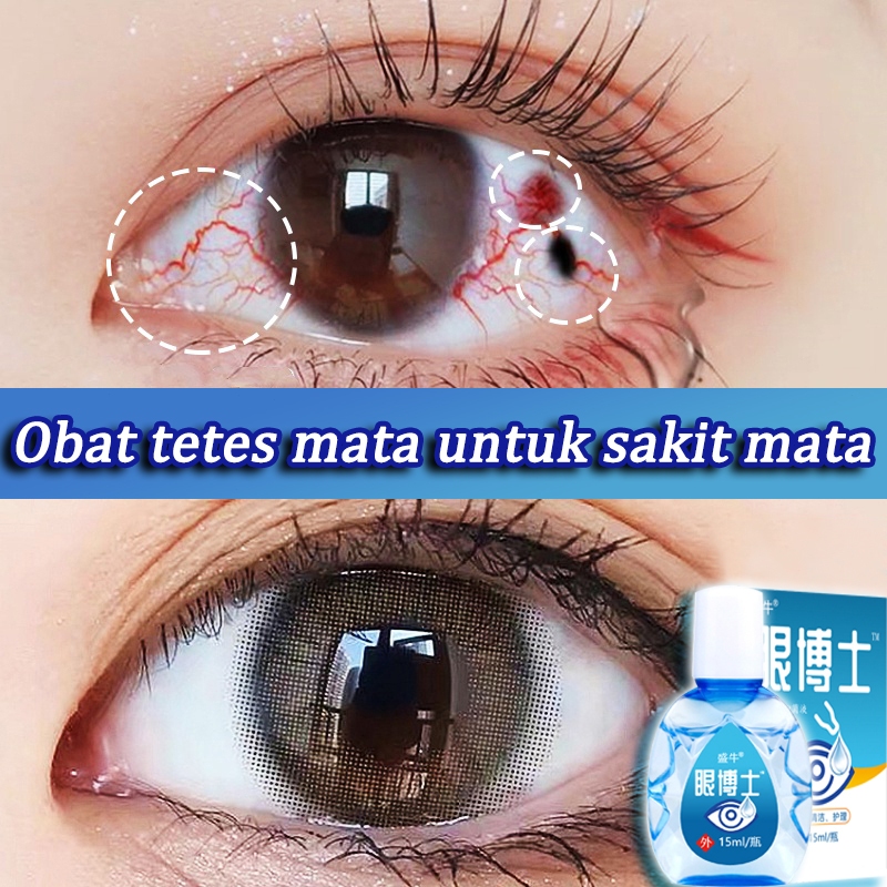 Jual Obat mata obat mata katarak obat tetes mata 15ml Mata kering Sakit ...