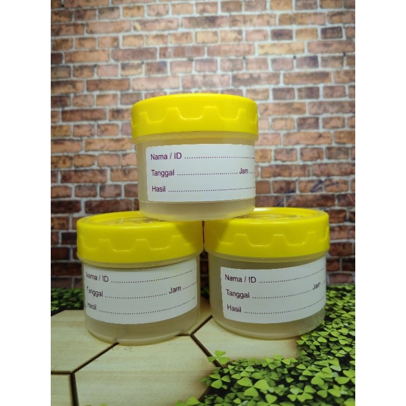 Jual POT DAHAK 50 ML ISI 25 PCS/PACK | POT SPUTUM | POT SUMPLE DAHAK ...