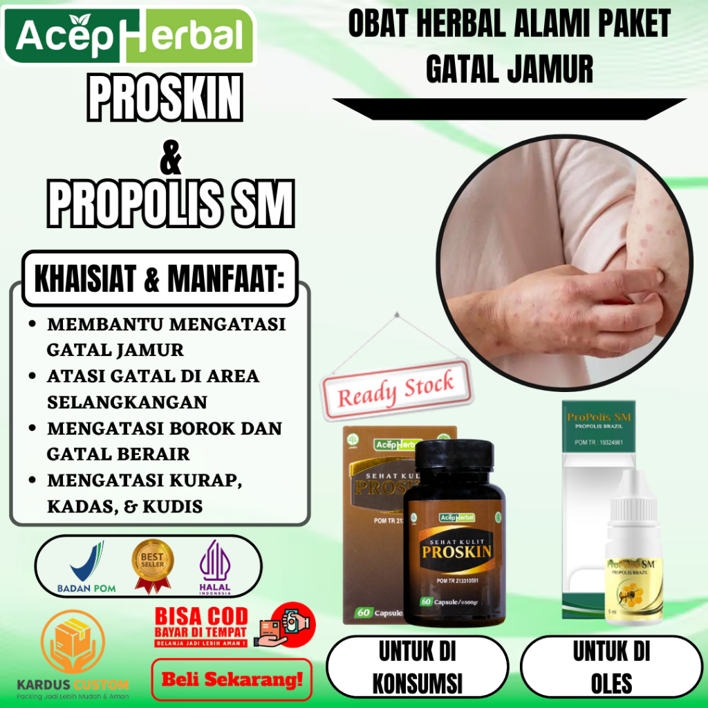 Jual Obat Gatal Jamur Obat Gatal Diarea Selangkangan Obat Borok Dan ...