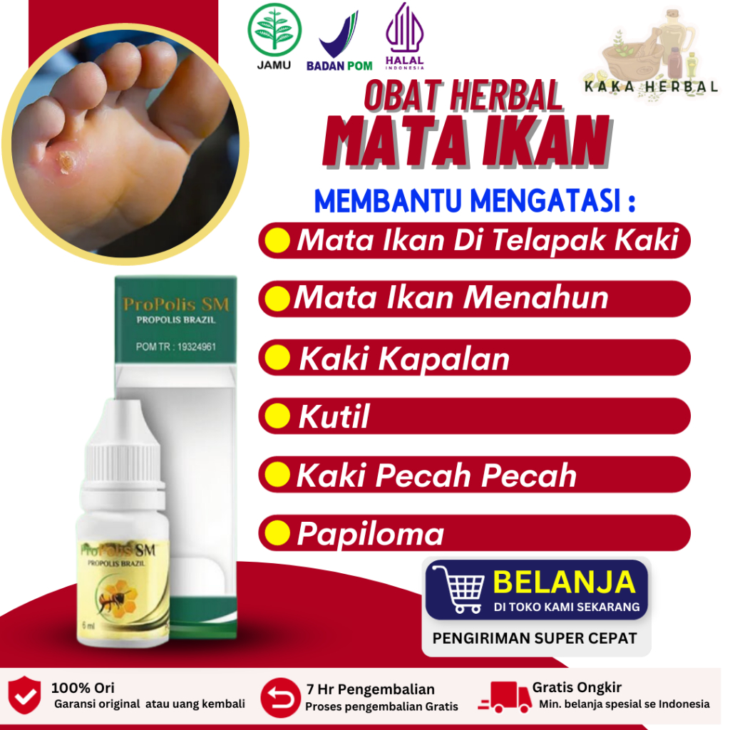 Jual Kaka Herbal - Obat Mata Ikan Di Telapak Kaki, Obat Tetes Mata Ikan ...