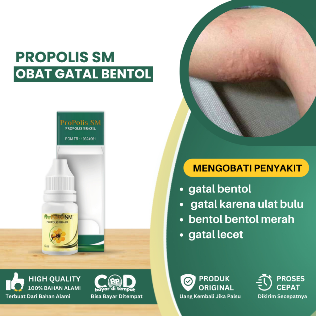 Jual Obat Gatal, Obat Gatal Karena Ulat Bulu, Obat Tetes Karena Ulat ...