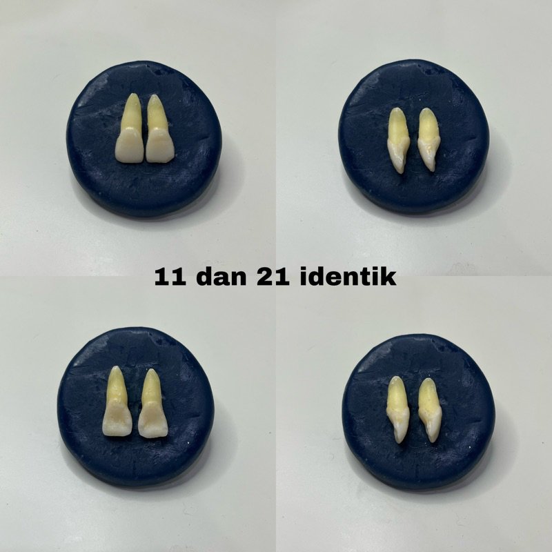 Jual Gigi Insisif 1 atas identik (gigi 21 22) insisivus sentral asli ...