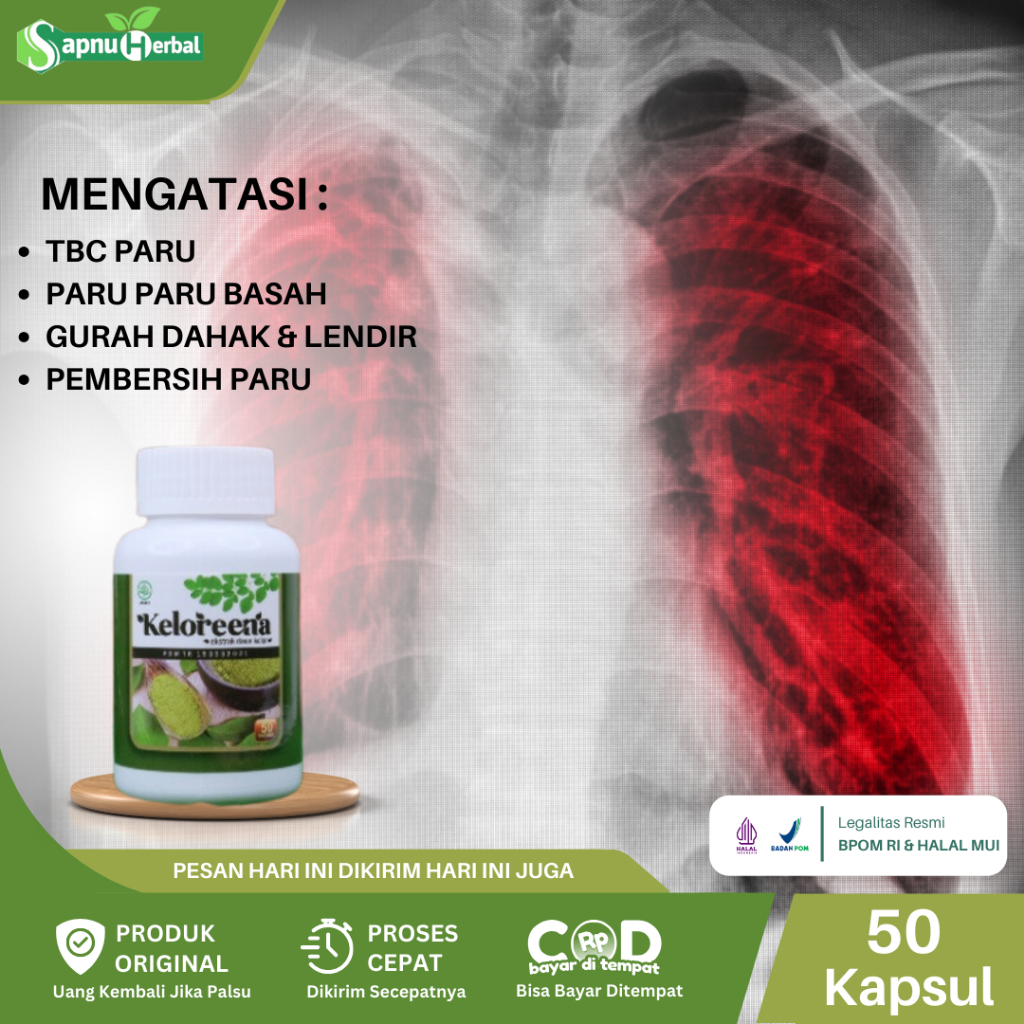 Jual Obat Gurah Dahak Dan Lendir Di Tenggorokan, Pembersih Lendir, Flek ...
