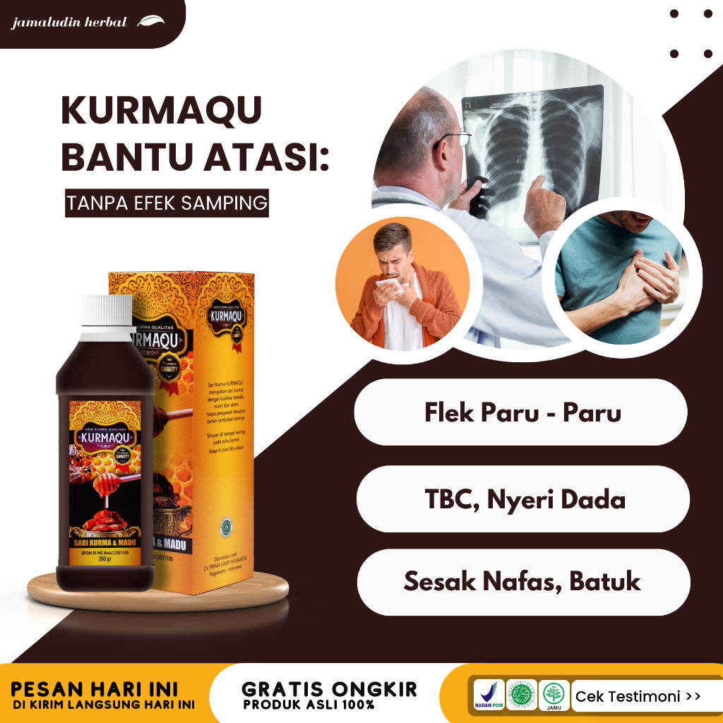 Jual Madu Kurma Obat Flek Paru Paru Radang Asma - Obat Paru Paru TBC ...