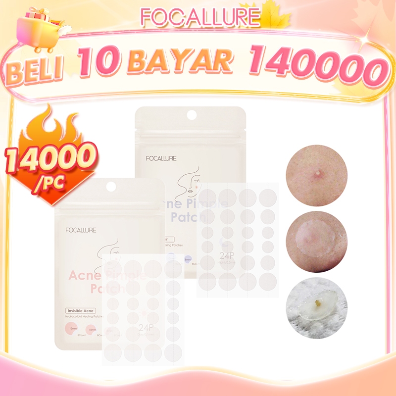 Jual FOCALLURE Spot Patch Acne Treatment Day/Night Skincare Acne ...