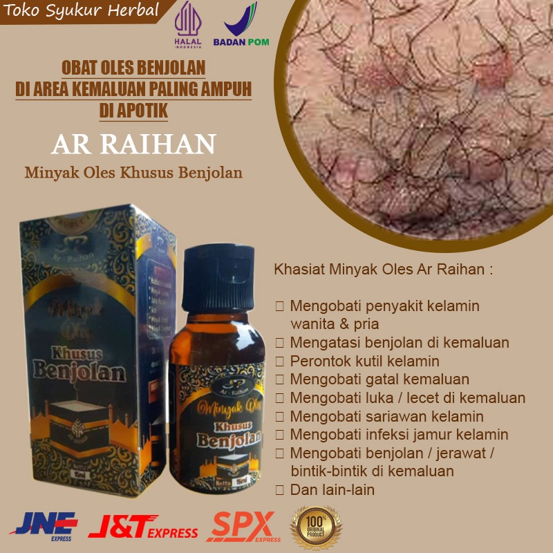 Jual Obat Oles Herbal Benjolan Kecil di Area Kemaluan, Salep Penghilang ...