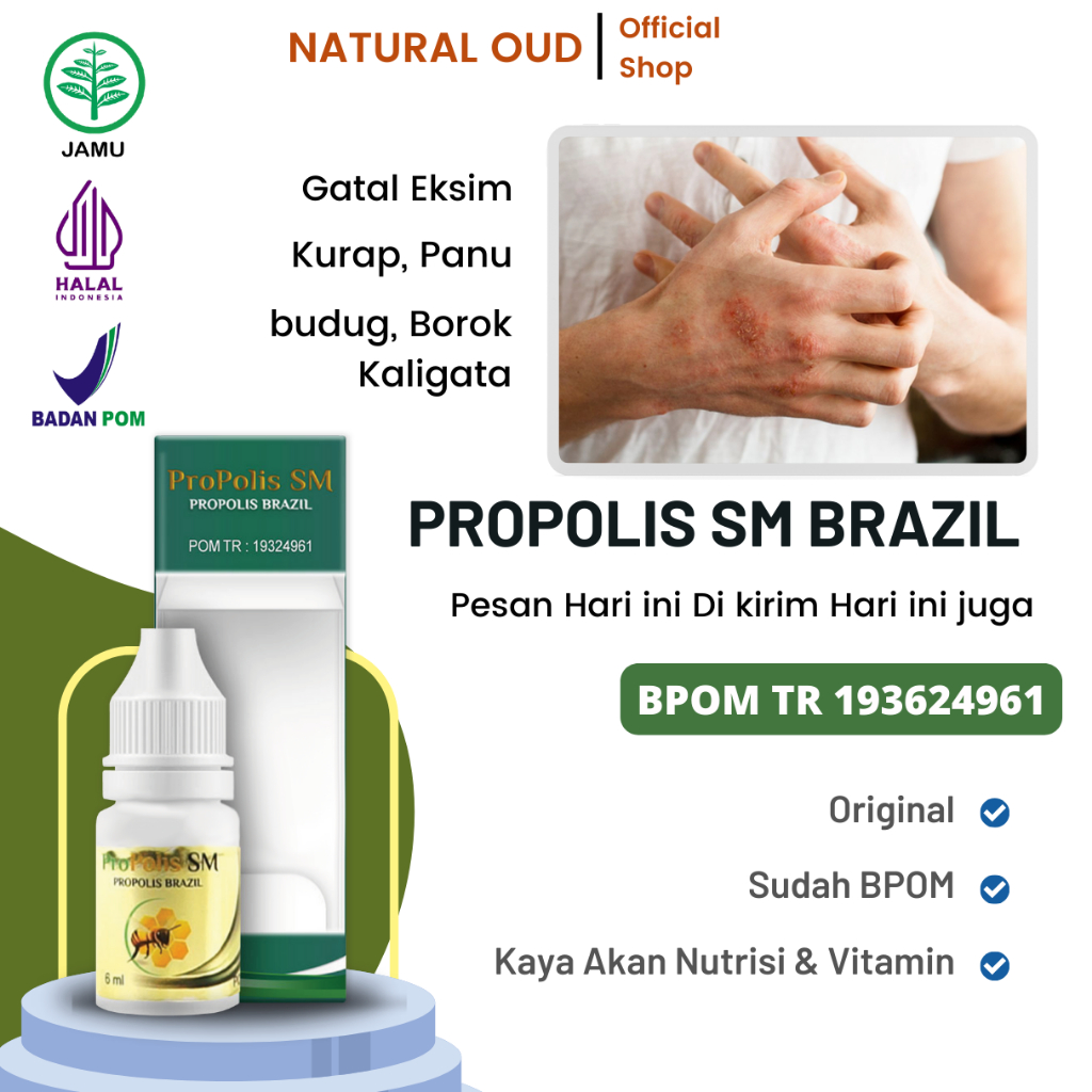 Jual Propolis SM Obat Gatal Gatal Eksim Kering Basah kurap Kadas Panu ...