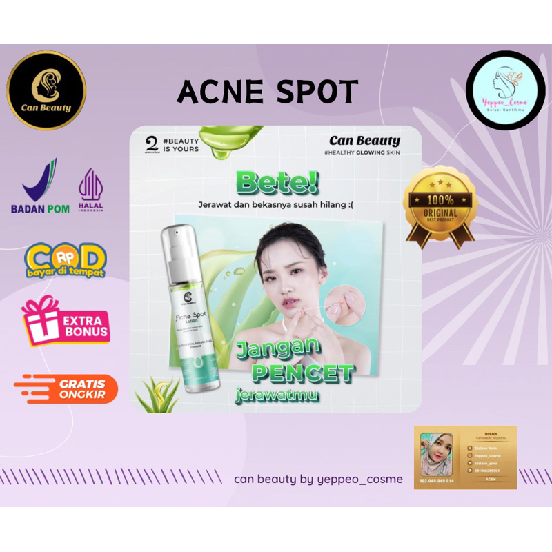 Jual ACNE SPOT LOTION TOTOL JERAWAT CAN BEAUTY | Shopee Indonesia