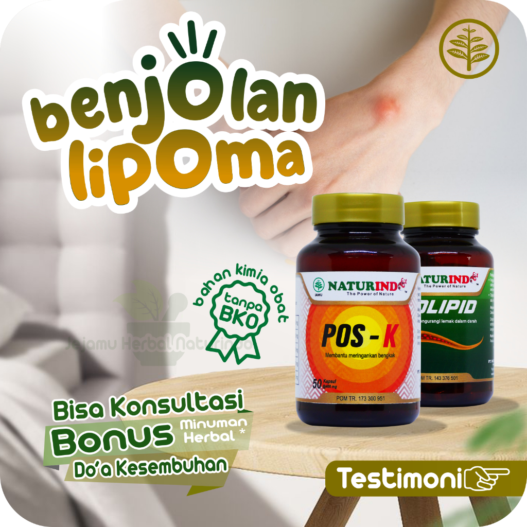 Jual Obat Lipoma Benjolan Lemak Kulit Ampuh Tanpa Operasi Lifoma ...