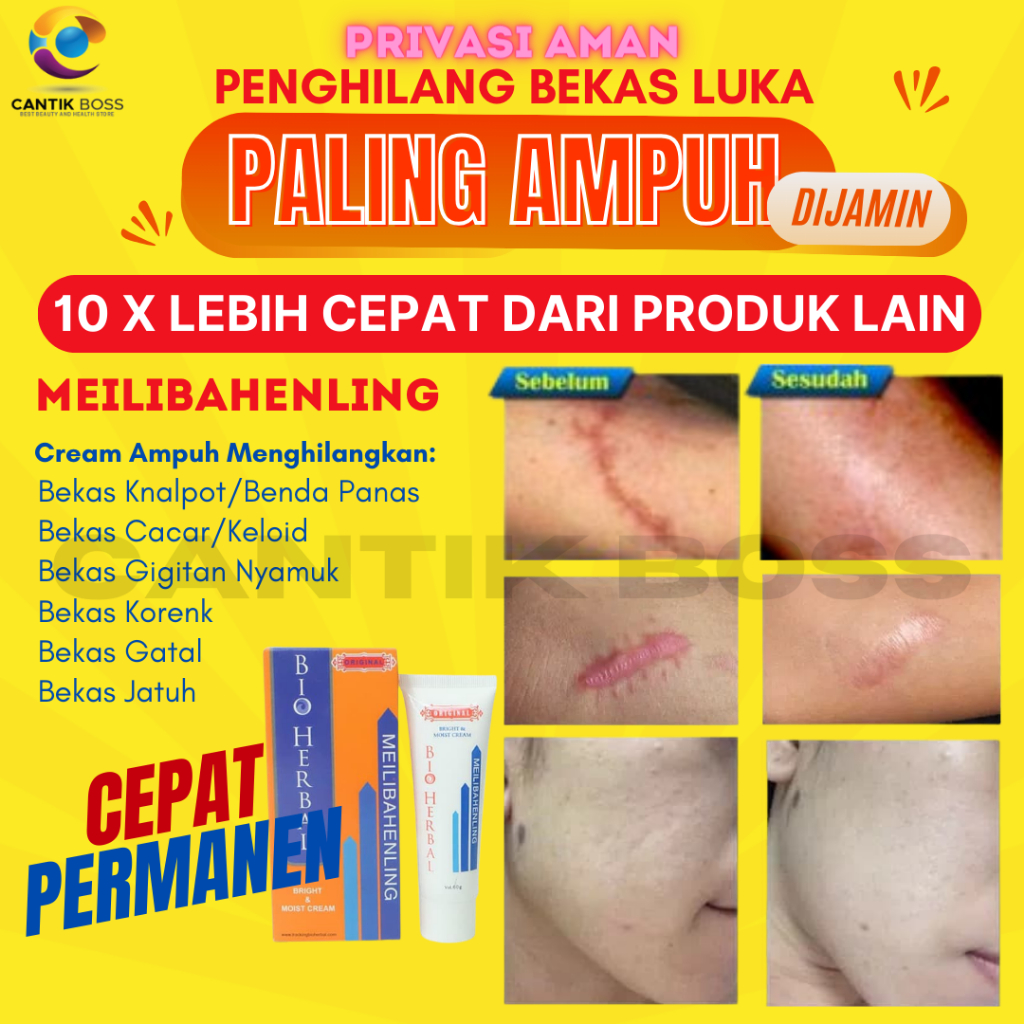 Jual Bio Herbal Meilibahenling Salep Cream Penghilang Bekas Luka Hitam ...
