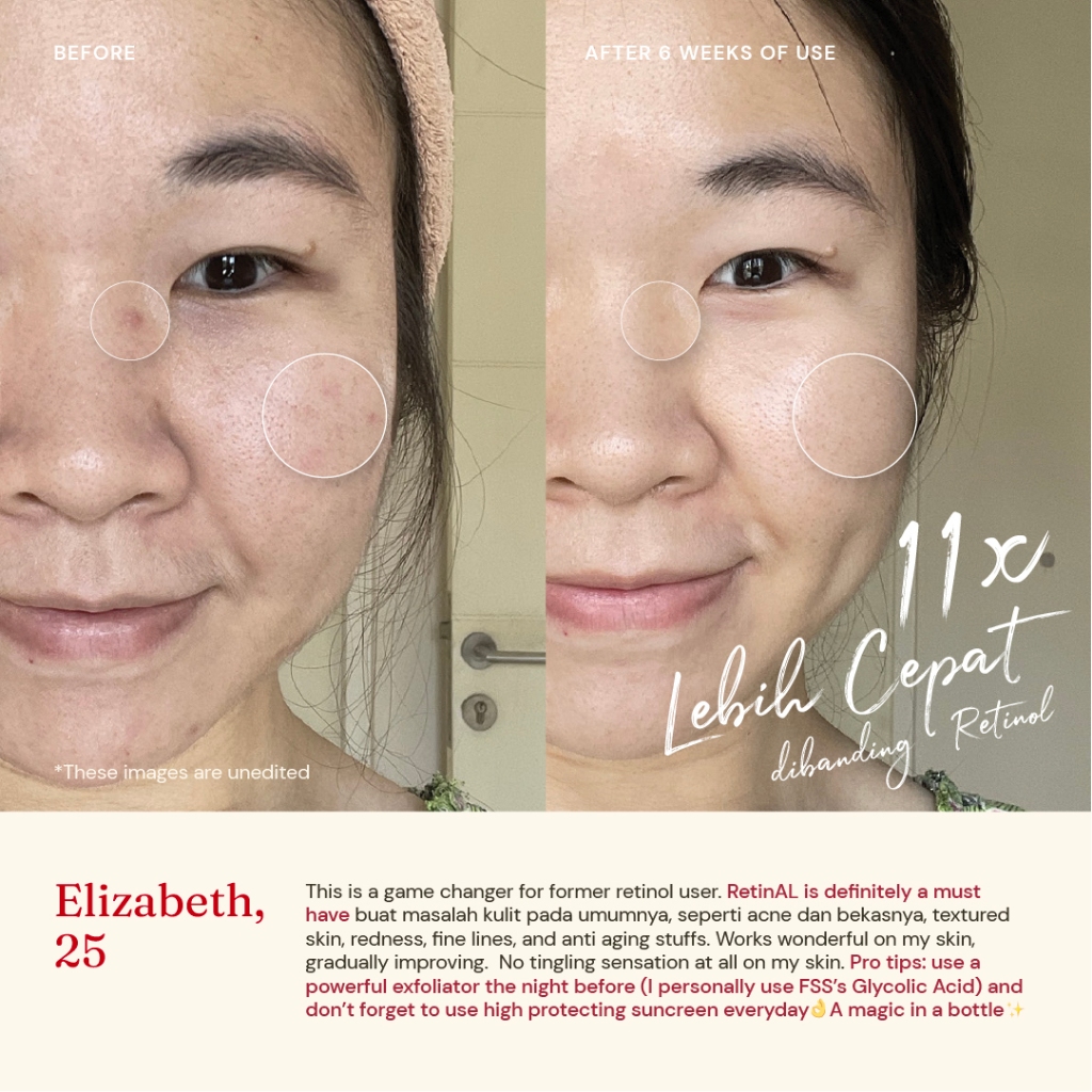 Jual For Skin's Sake FSS RetinAL Serum 0.15% Serum Retinoid Memudarkan ...