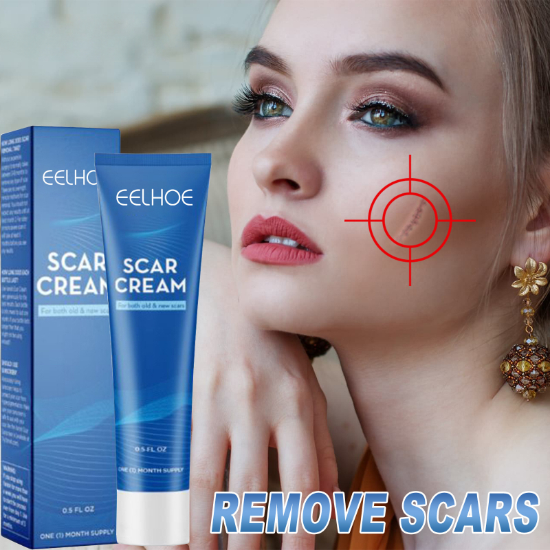 Jual Scar Removal Cream Repairing Pock Mark Burn Surgical Scar Cesarean ...