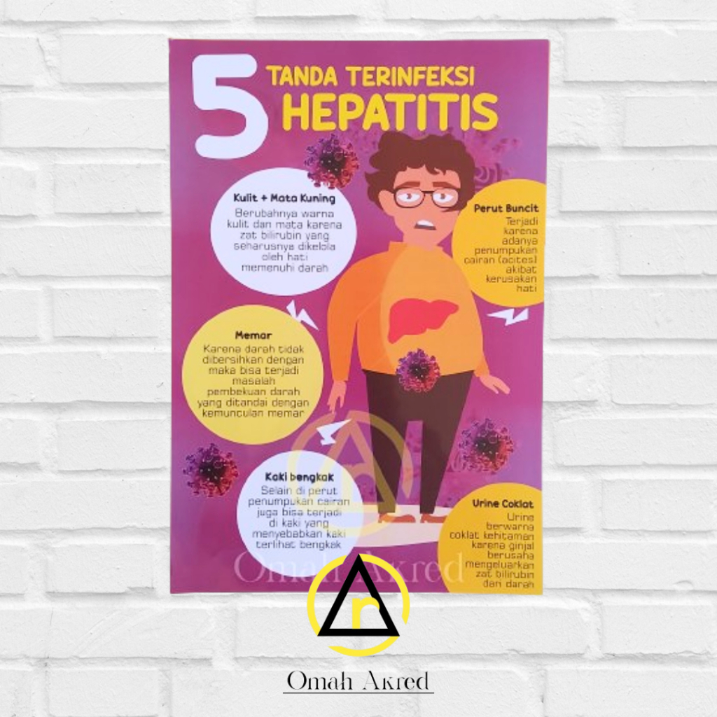 Jual Poster 5 Tanda Terinfeksi Hepatitis - Poster Penyakit | Shopee ...