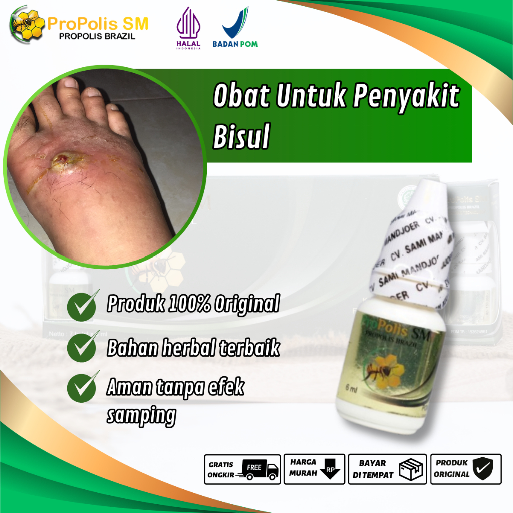 Jual Obat Bisul Herbal, Bisul Di Pantat, Benjolan Bernanah, Bisul Kulit ...