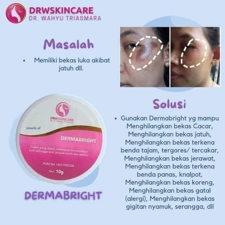 Jual DERMABRIGHT (KRIM BEKAS LUKA) | Shopee Indonesia