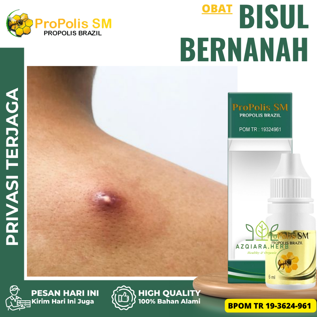 Jual Obat Bisul Bernanah, Obat Tetes Bisulan Cenang, Obat Penghilang ...