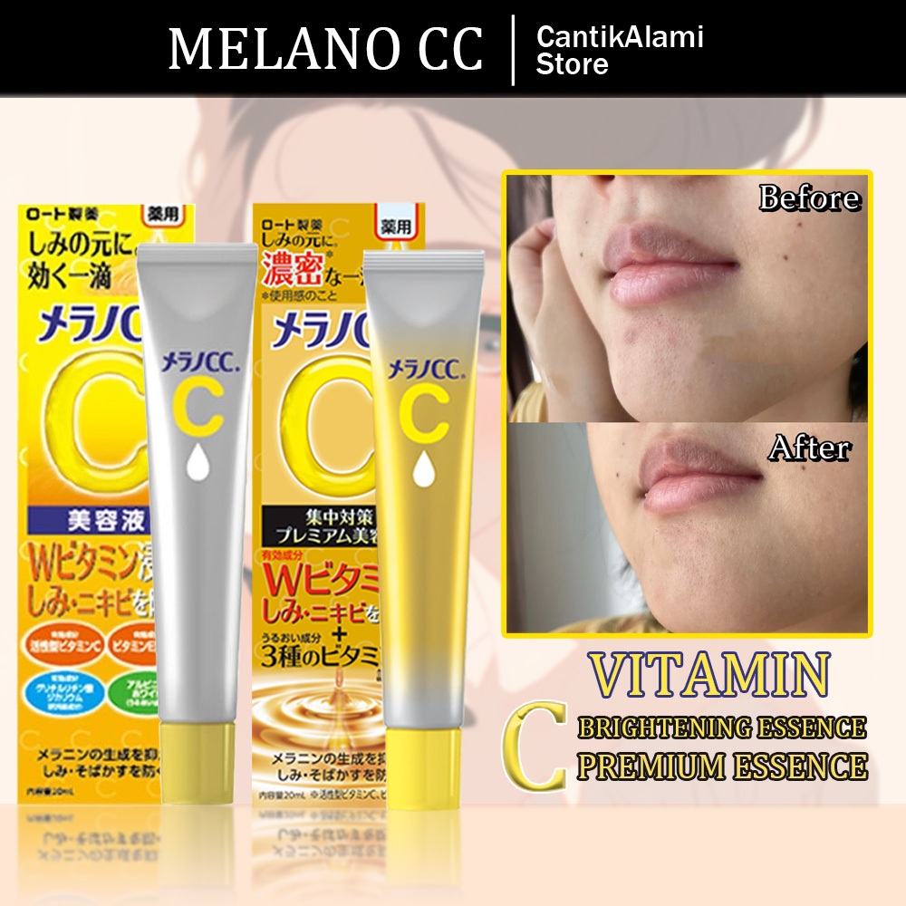 Jual Melano CC Vitamin C Serum Anti-Spot Brightening Essence Premium Essence 20ml | Shopee Indonesia