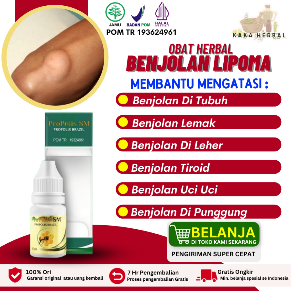 Jual Propolis SM Obat Herbal Alami Penghilang Benjolan Lipoma ...