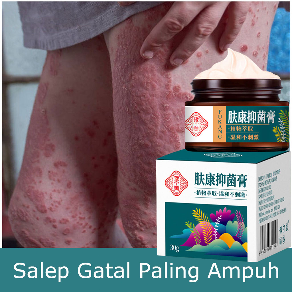 Jual 【100% Original】salep gatal paling ampuh Salep gatal Salep ...