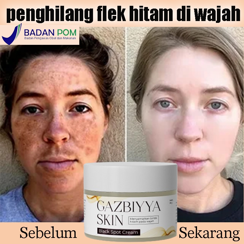 Jual [BPOM]penghilang flek hitam membandel flek hitam di wajah membandel cream flek hitam ...