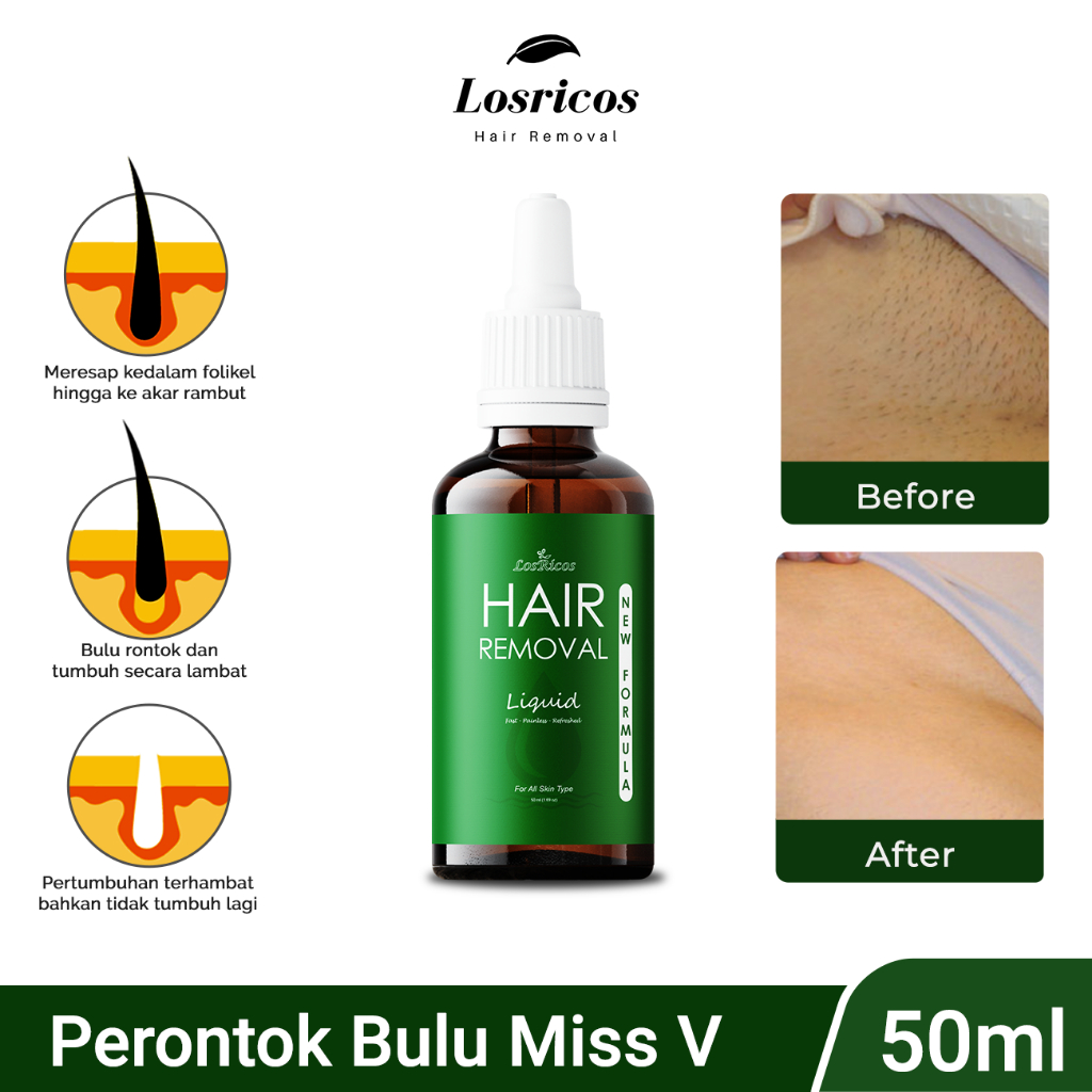Jual Losricos Perontok Bulu Miss V Permanen Liquid Hair Removal ...