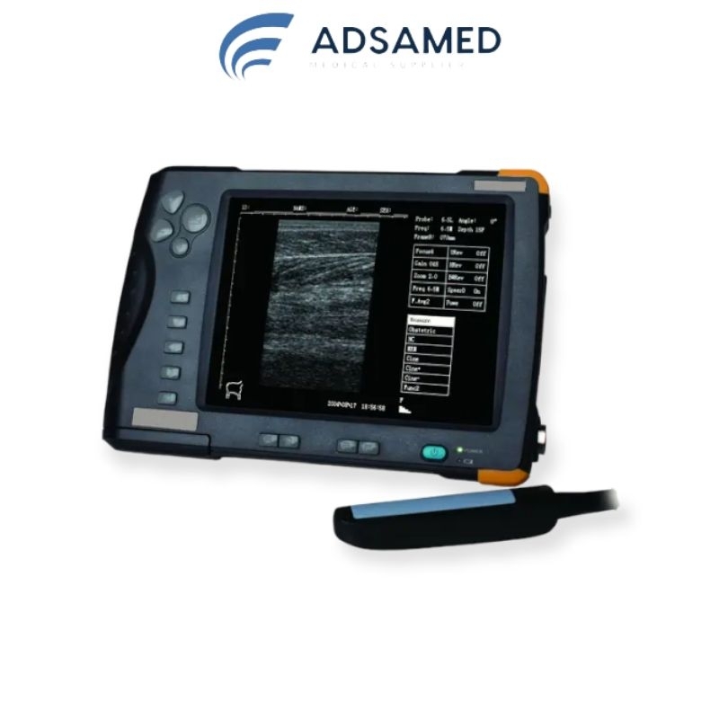 Jual USG Vet MSLVU30 / Veterinary Ultrasound Portable | Shopee Indonesia