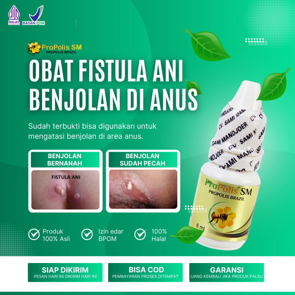 Jual Obat Fistula Ani, Obat Abses Anus, Obat Benjolan Di anus, Obat ...