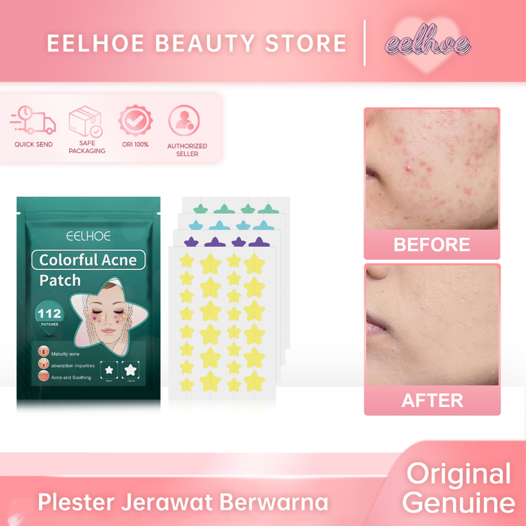 Jual EELHOE Acne Patch Lucu 112 Pcs Pimple Patch Memperbaiki Patch ...