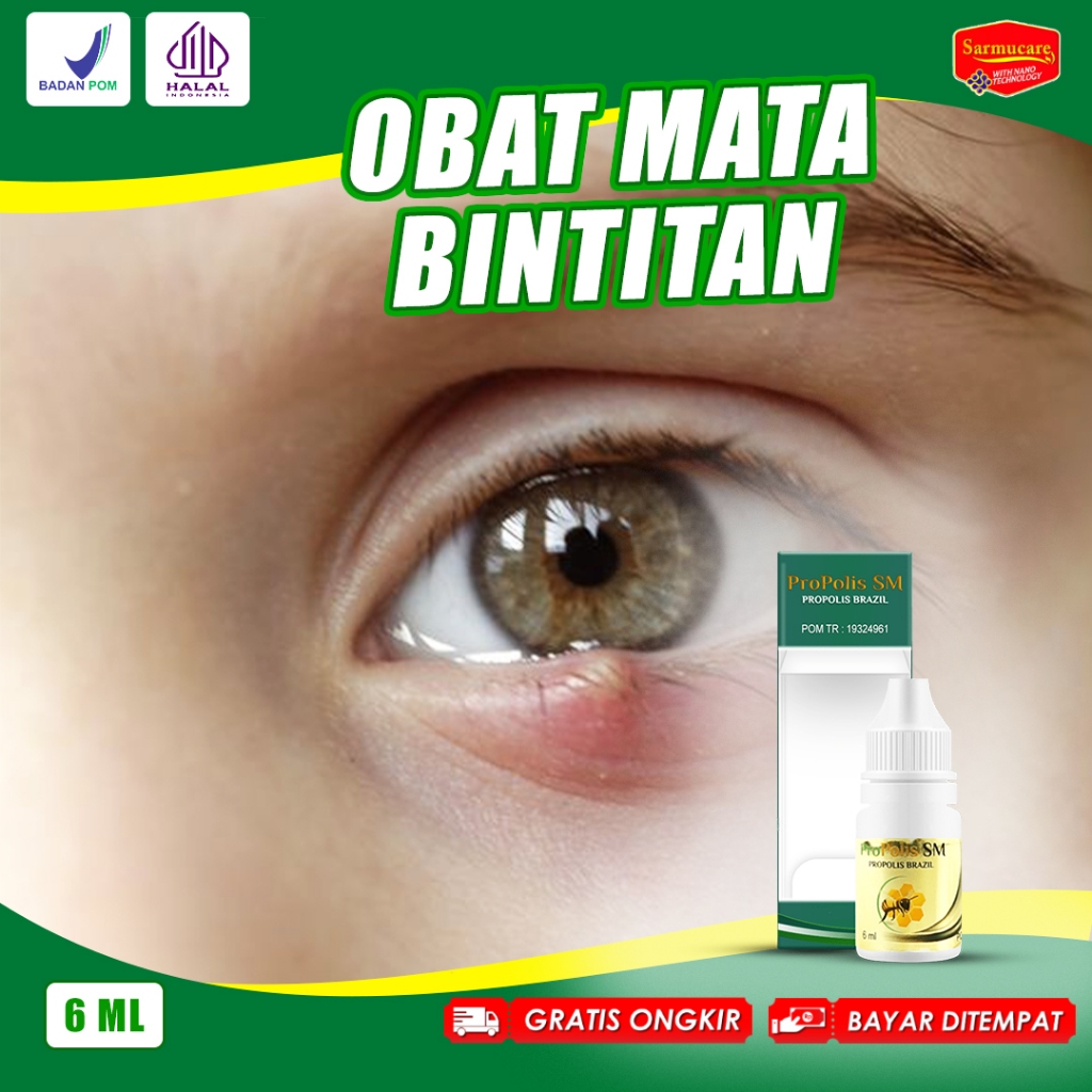 Jual Obat Bintitan Mata Kelopak Mata Bengkak Bisul Dikelopak Mata ...