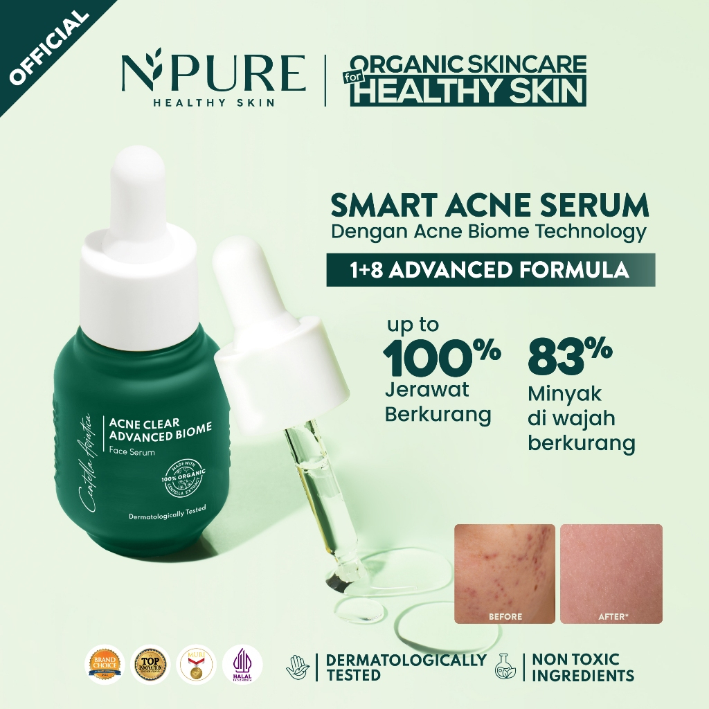 Jual NPURE CICA BIOME ACNE SERUM ESSENCE | Shopee Indonesia