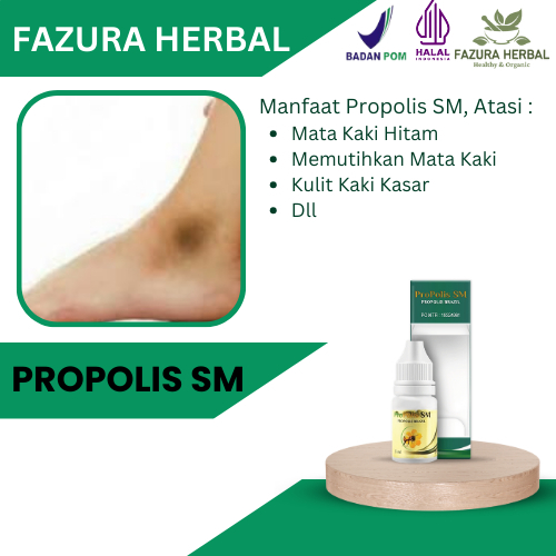 Jual Propolis SM - Obat Mata Kaki Hitam, Obat Pemutih Mata Kaki, Obat ...