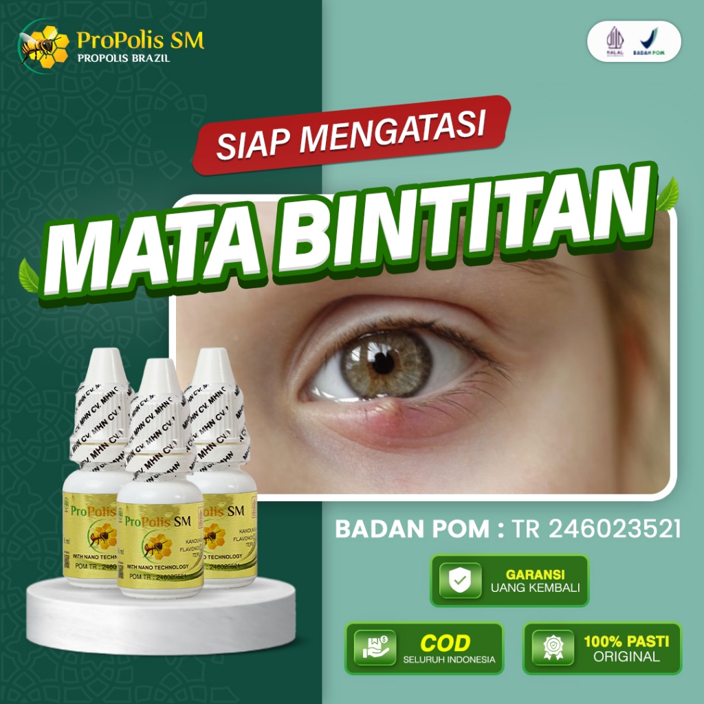 Jual Obat Mata Bintitan Bintilan Kalazion Benjolan Di Mata Pengempis ...