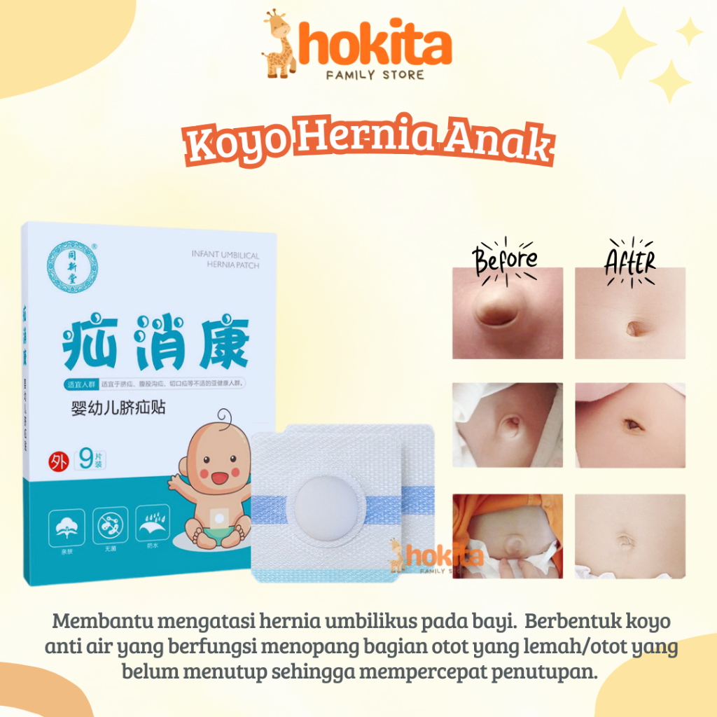 Jual Koyo Herbal Hernia Anak Patch / Umbilical Hernia Belt Baby / Anti ...