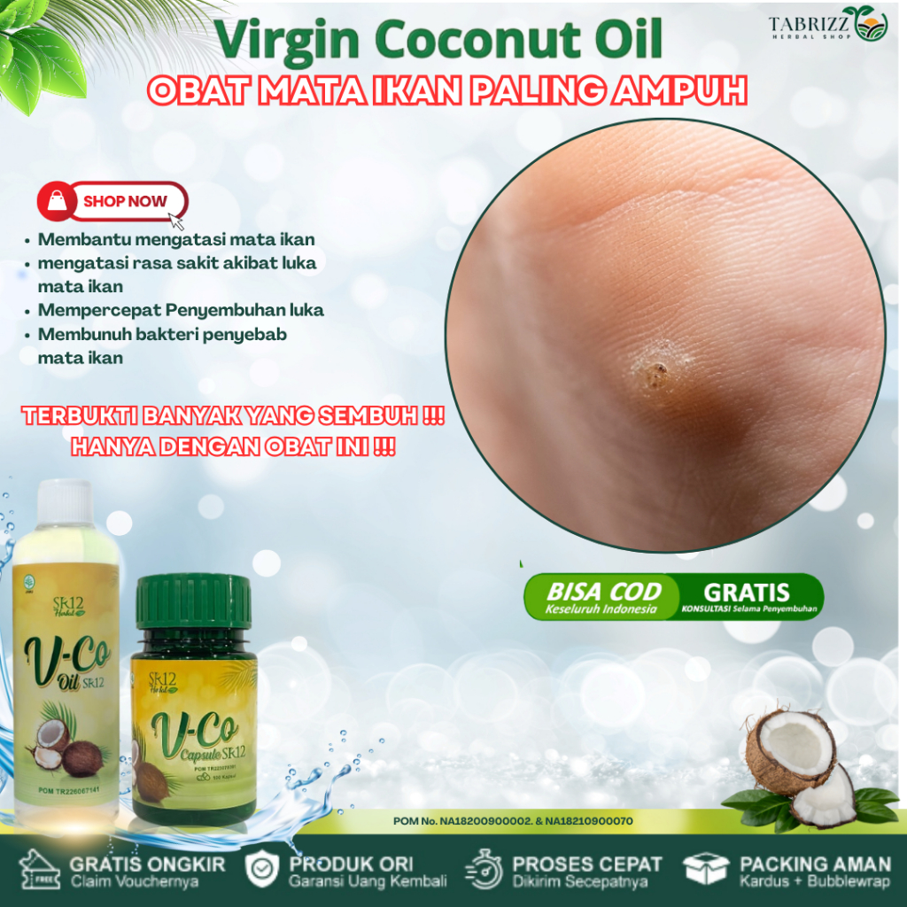 Jual Obat Mata Ikan Paling Ampuh, Perontok Mata Ikan di Telapak Kaki ...