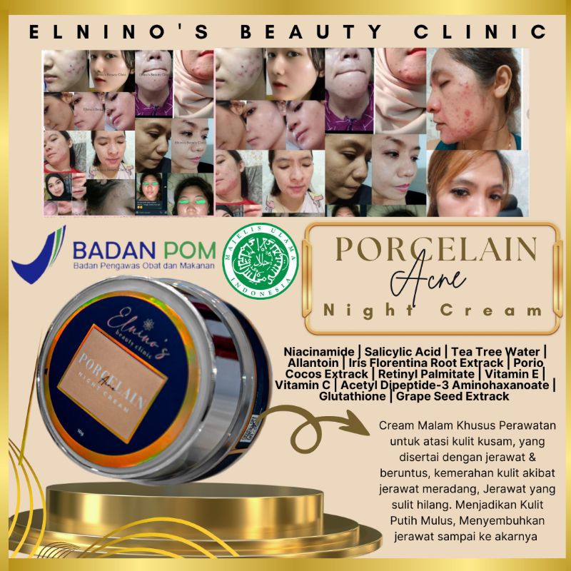 Jual ELNINO'S - CREAM MALAM PORCELAIN SKIN [KULIT KUSAM, ACNE, BERUNTUS ...