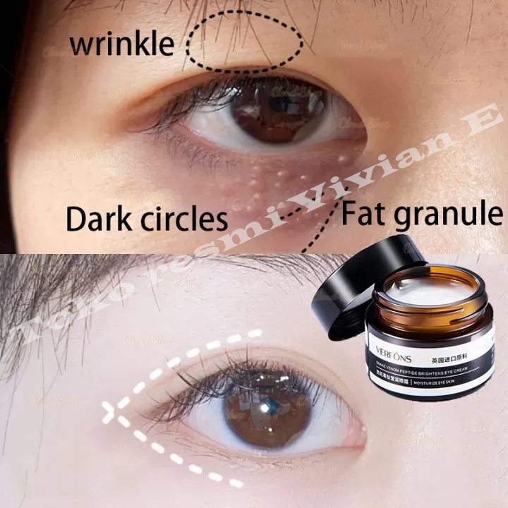 Jual Krim Mata Anti Kerutan Cream Menghilangkan Kantung Mata dan Mata ...