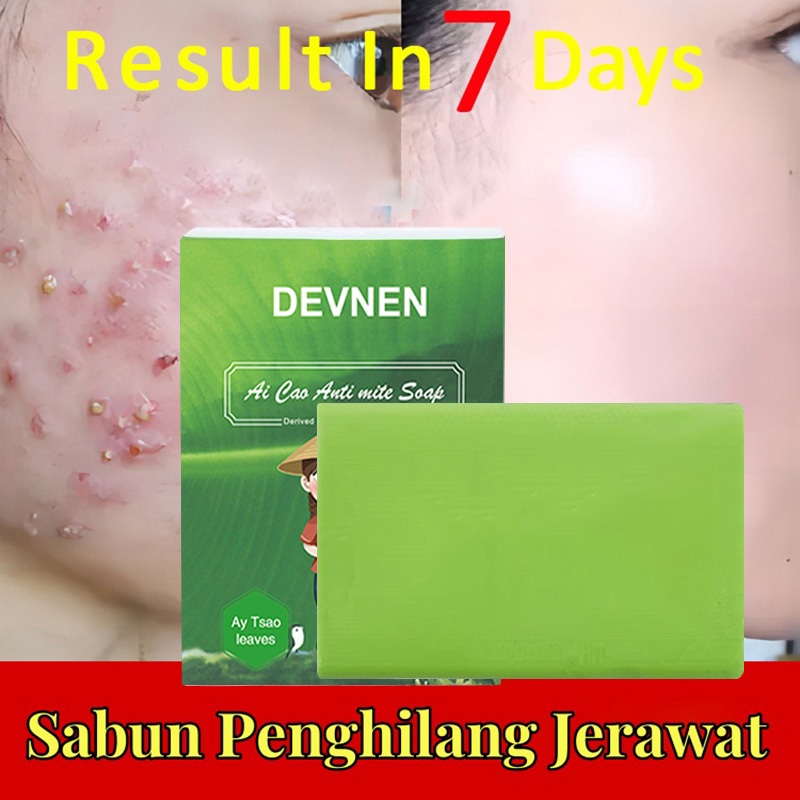 Jual Sabun Gatal Kulit Wormwood Mite Removal Pemutih Badan Soap 80g ...