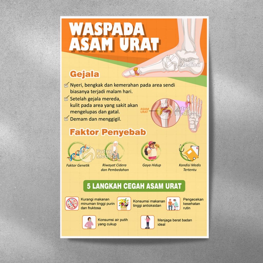 Jual Poster Kesehatan Waspada Asam Urat A3+ / Gambar Edukasi Cegah Gout ...