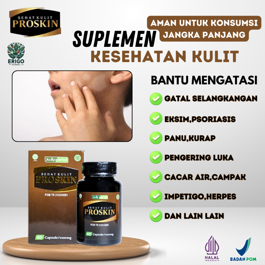 Jual Proskin Obat Panu Perontok Jamur Kulit Kadas Kurap Panuan Kulit ...