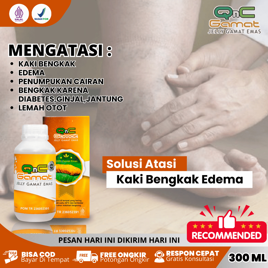 Jual Obat Kaki Bengkak Karena Ginjal Jantung Diabetes Edema Kaki ...