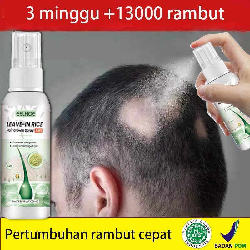 Jual Serum penumbuh rambut Obat penumbuh rambut Penumbuh rambut botak ...