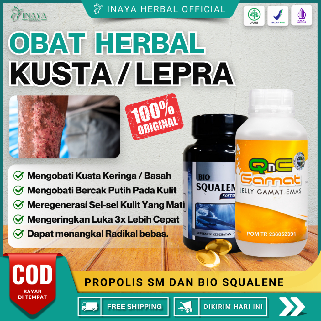 Jual Obat Herbal Kusta / Lepra, Obat Kulit Kaku dan Kering, Kulit Mati ...