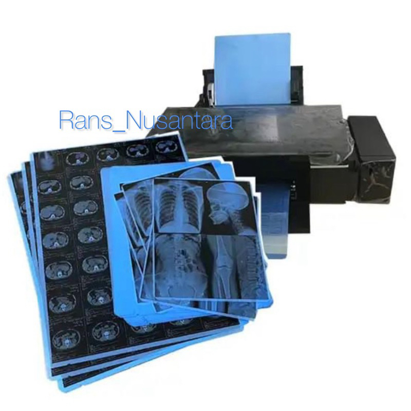 Jual Film XRay Radiologi / Film X-Ray Blue / Film Radiology / Foto ...
