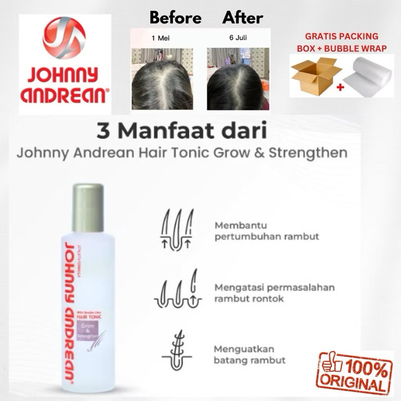 Jual Jonny Andrean hair tonic || Hair tonik Johnny Andrean 150ml | Shopee Indonesia