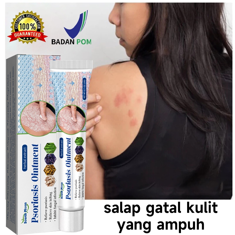 Jual Salap Gatal Kulit Yang Ampuh Salep Gatal Salep Khusus Psoriasis ...