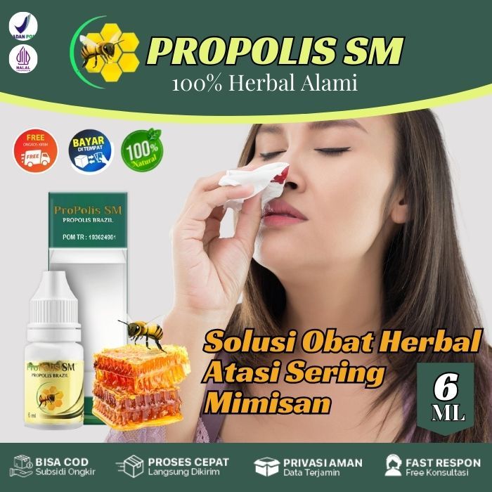 Jual Obat Sering Mimisan Epistaksis Radang Hidung Aman Untuk Anak Dan Dewasa Propolis SM ...
