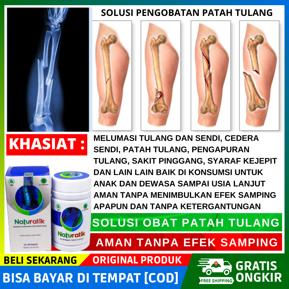 Jual Obat Patah Tulang Paling Ampuh Patah Tulang Retak Remuk Kaki ...