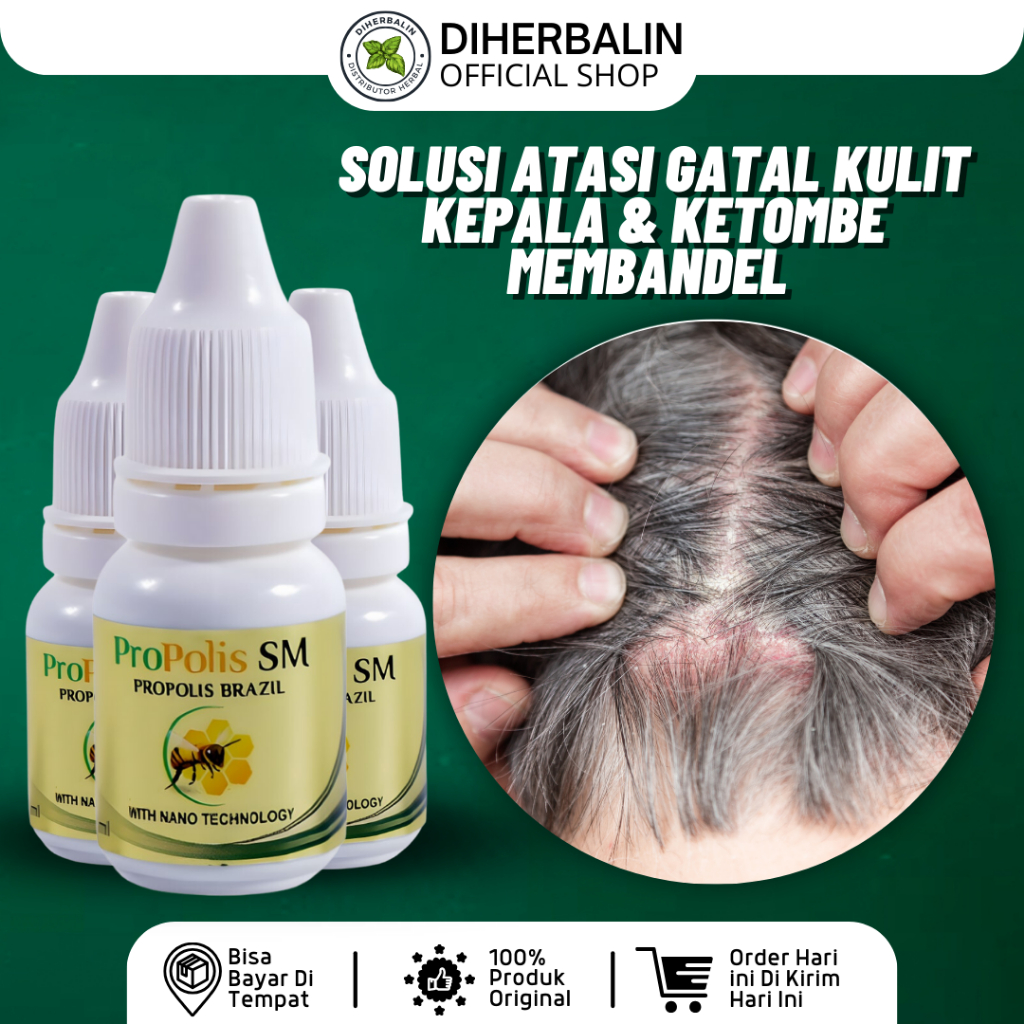 Jual Propolis SM Atasi Ketombe Gatal Kulit Kepala Berkerak Psoriasis 6ml | Shopee Indonesia