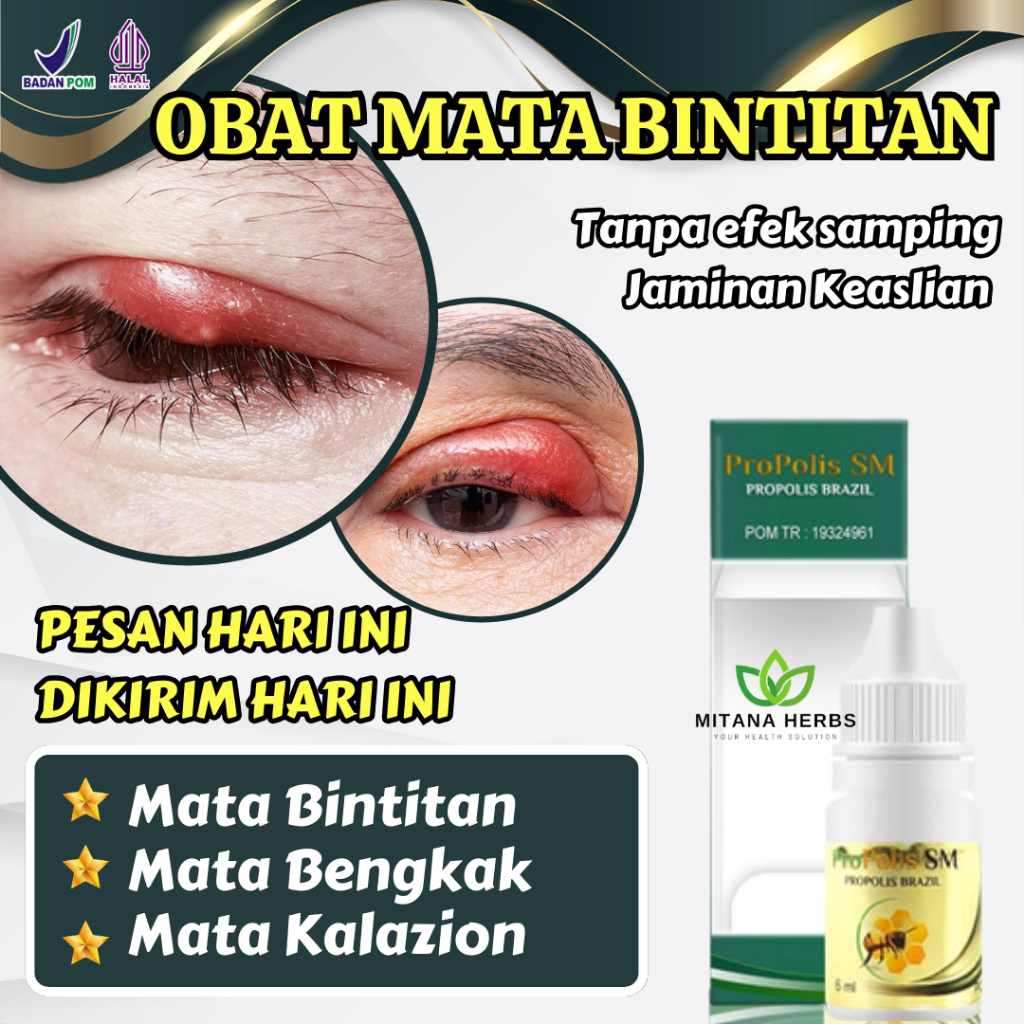 Jual Obat Mata Bintitan - Obat Mata Kalazion - Obat Mata Bintitan Cendo ...